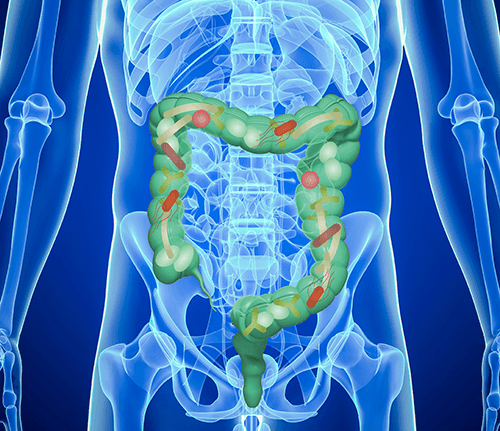 OptiFibre: Natürliche Unterstützung bei gereiztem Darm